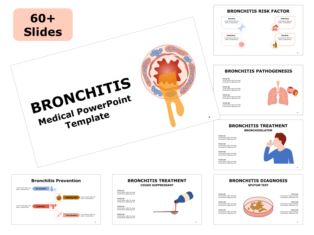 Bronchitis PowerPoint Template - RxSlides - The largest online store for medical PowerPoint ...